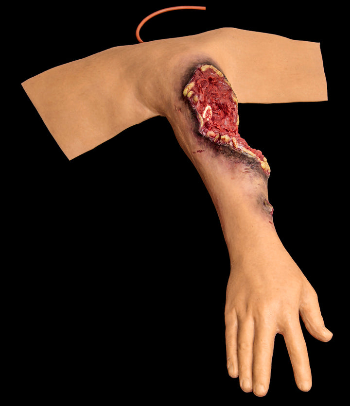 severed arm